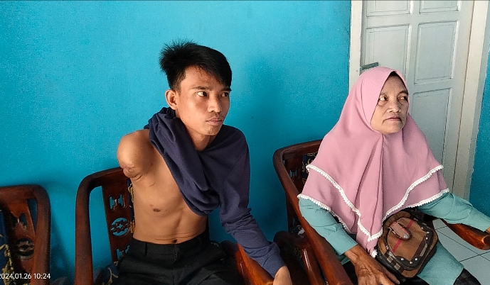 Korban Kecelakaan Kerja Hingga Cacat Permanen, Terkesan Diabaikan Oleh ...